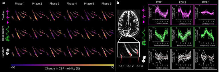 Cerebrospinal fluid motion in the brain captured in remarkable detail