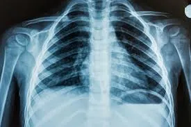 10 Lab Accidents That Created World-Changing Discoveries