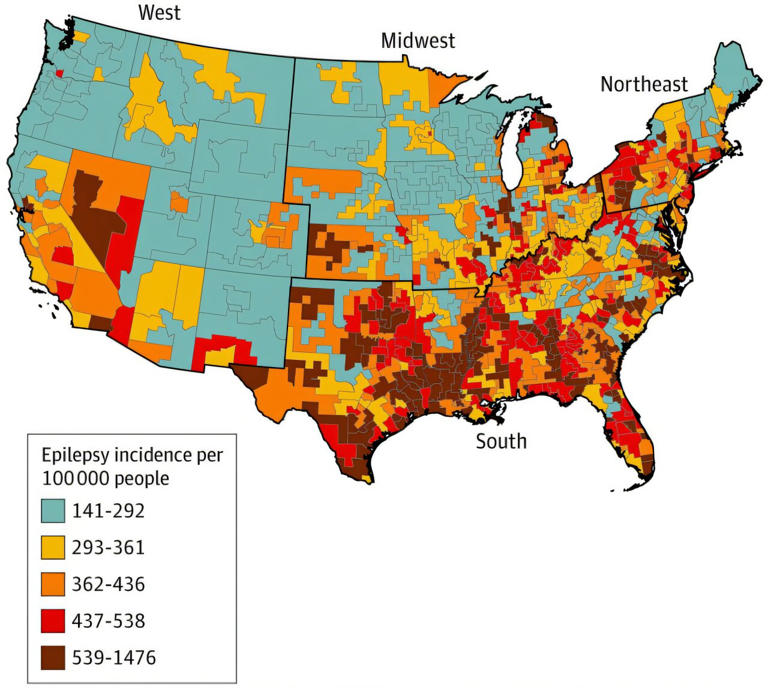 Discovering America's 'epilepsy belt': Study reveals US regions with ...