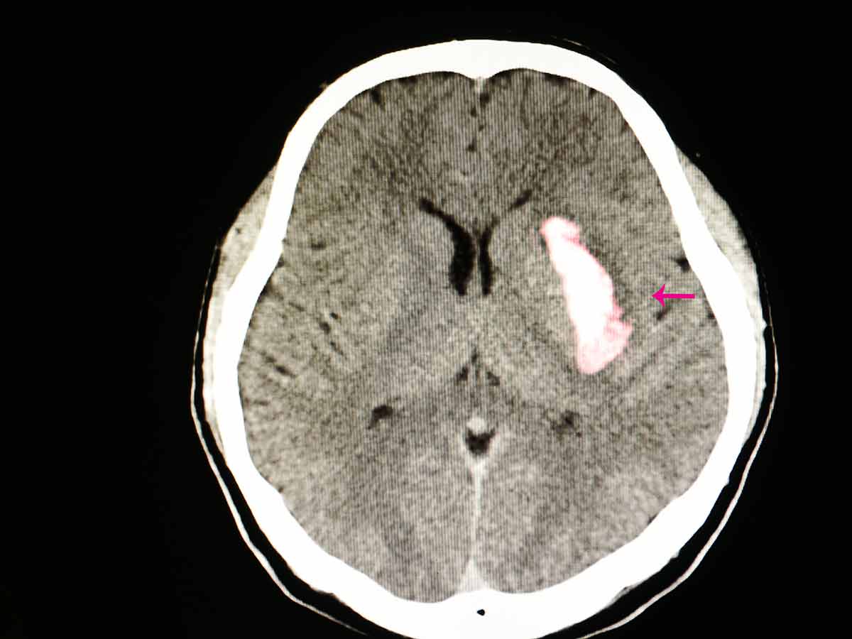 35 medical procedures with the highest risks and complications