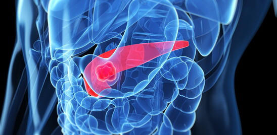 Tumori: +10% di pazienti vivi dopo una diagnosi di cancro al pancreas
