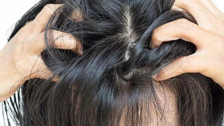 How many times should you wash your hair during winter