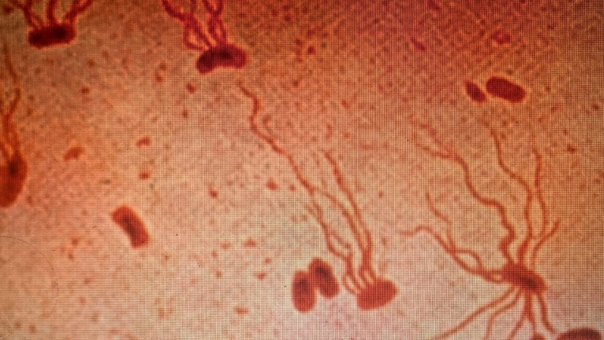 Ancient killer is rapidly gaining resistance to antibiotics, study warns