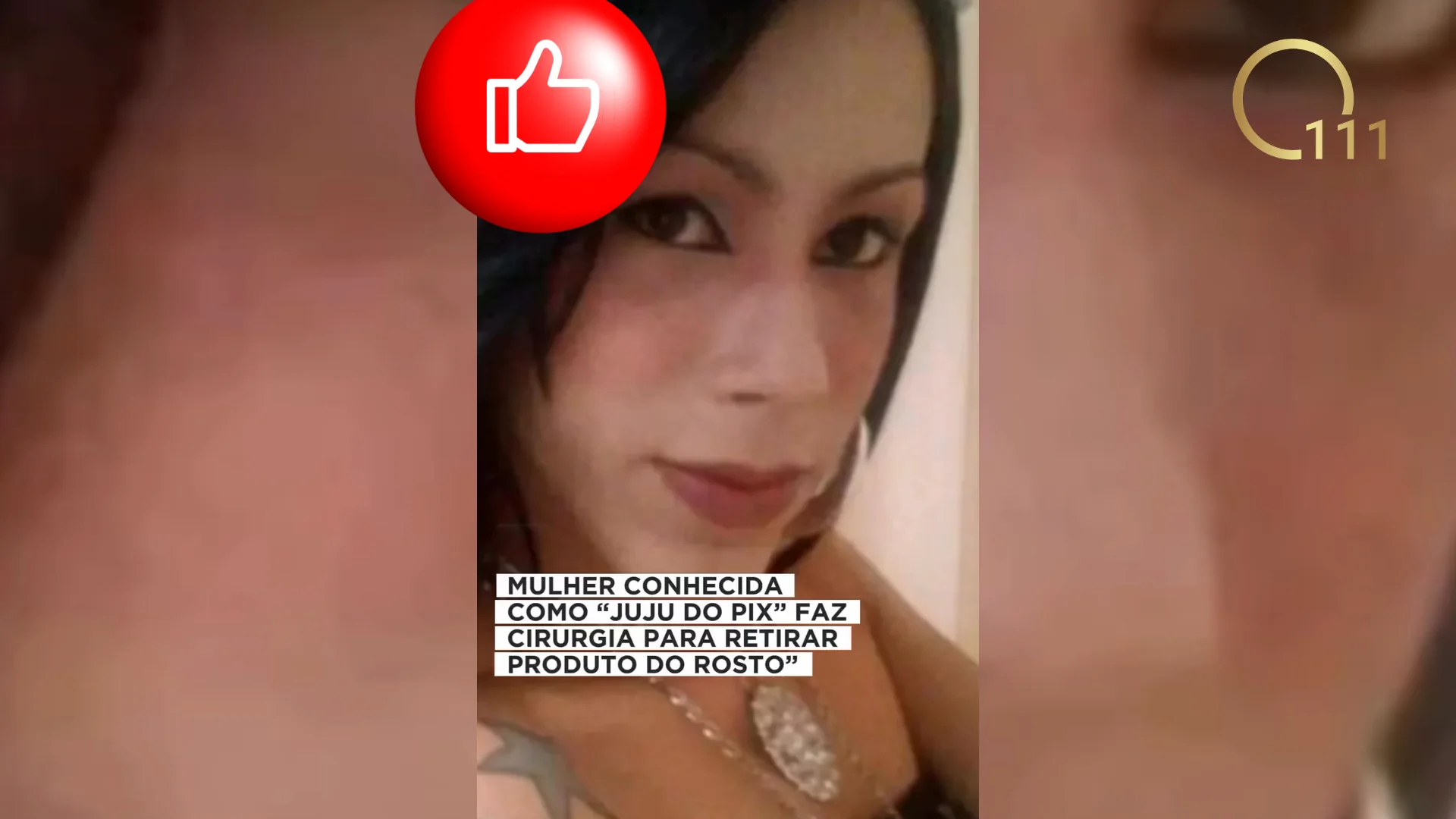Mulher conhecida como "Juju do Pix" faz cirurgia para retirar produto ...