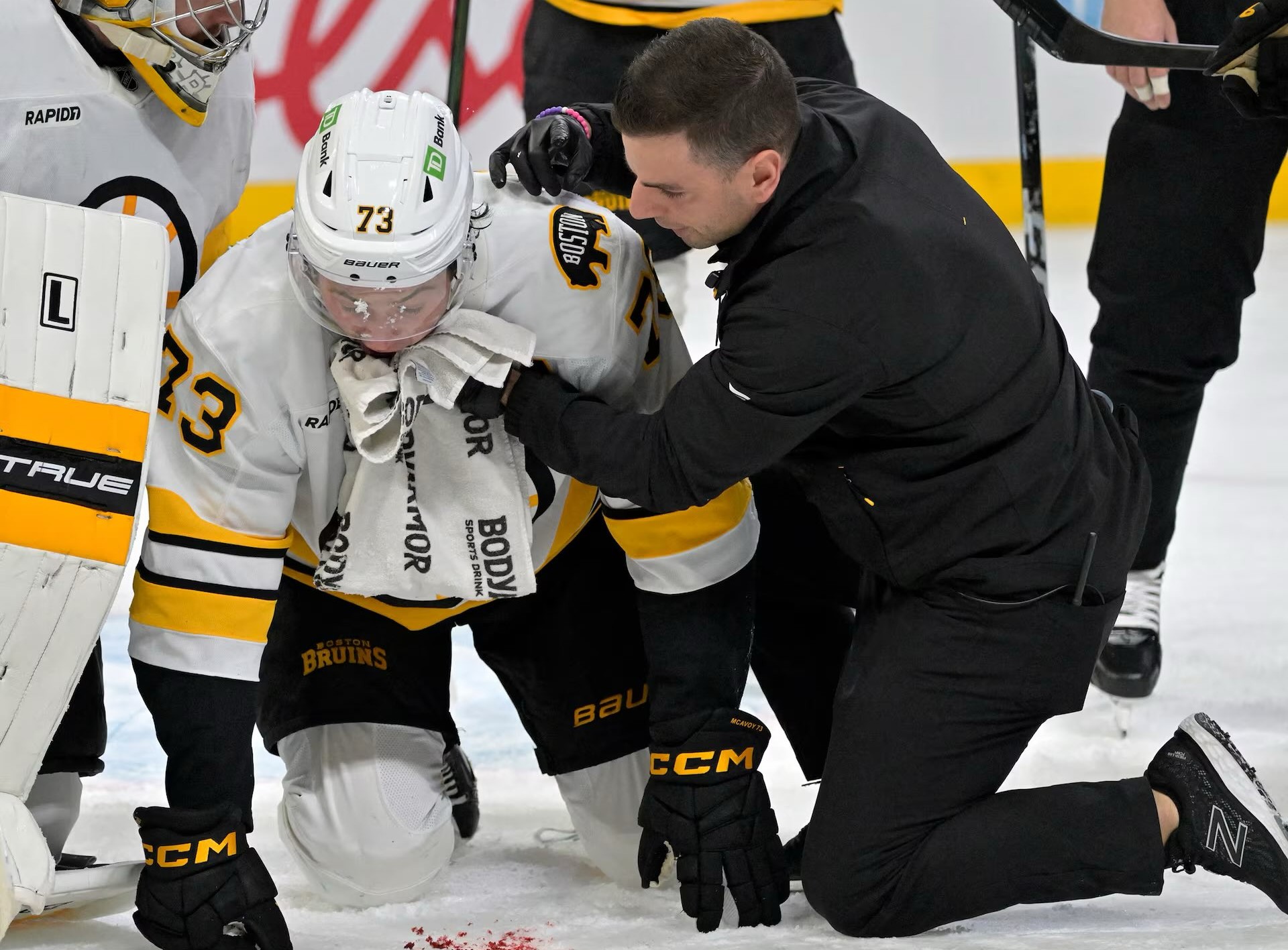 Charlie McAvoy: No solid food for two or three months