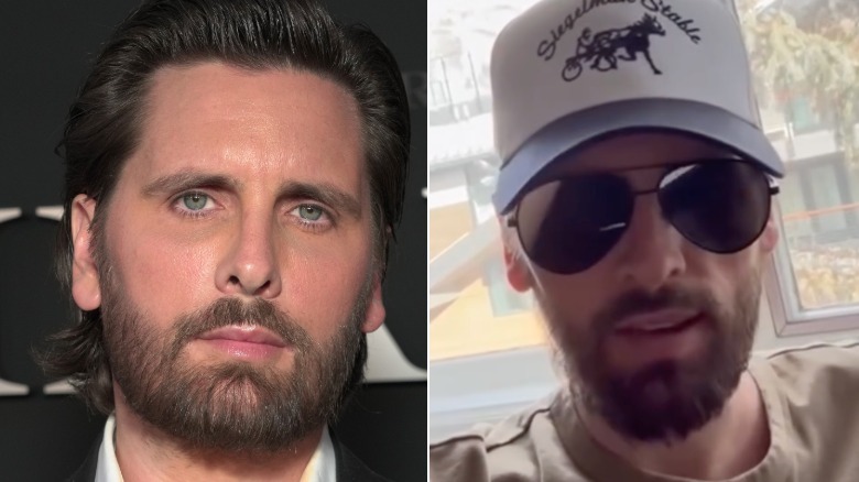 Side-By-Side Photos Of Scott Disick's Face Transformation Are Wild To See