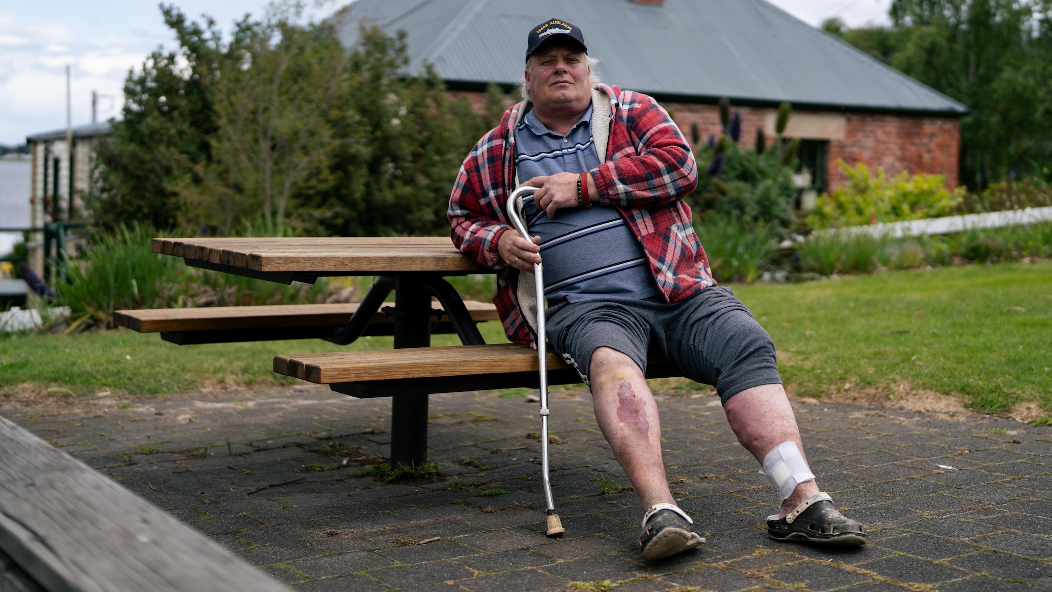 Tasmanian man's wait for surgery stretches into years as daily pain ...
