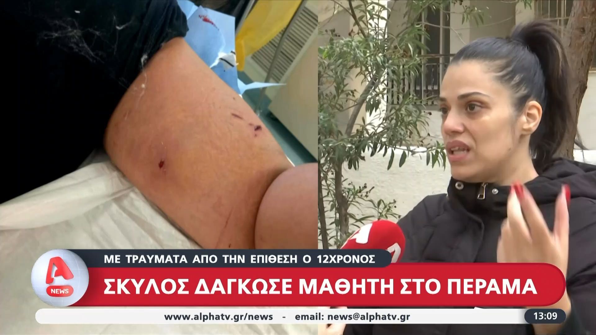 Πέραμα: Σκύλος επιτέθηκε σε 12χρονο μαθητή – Νοσηλεύεται με σοβαρά τραύματα