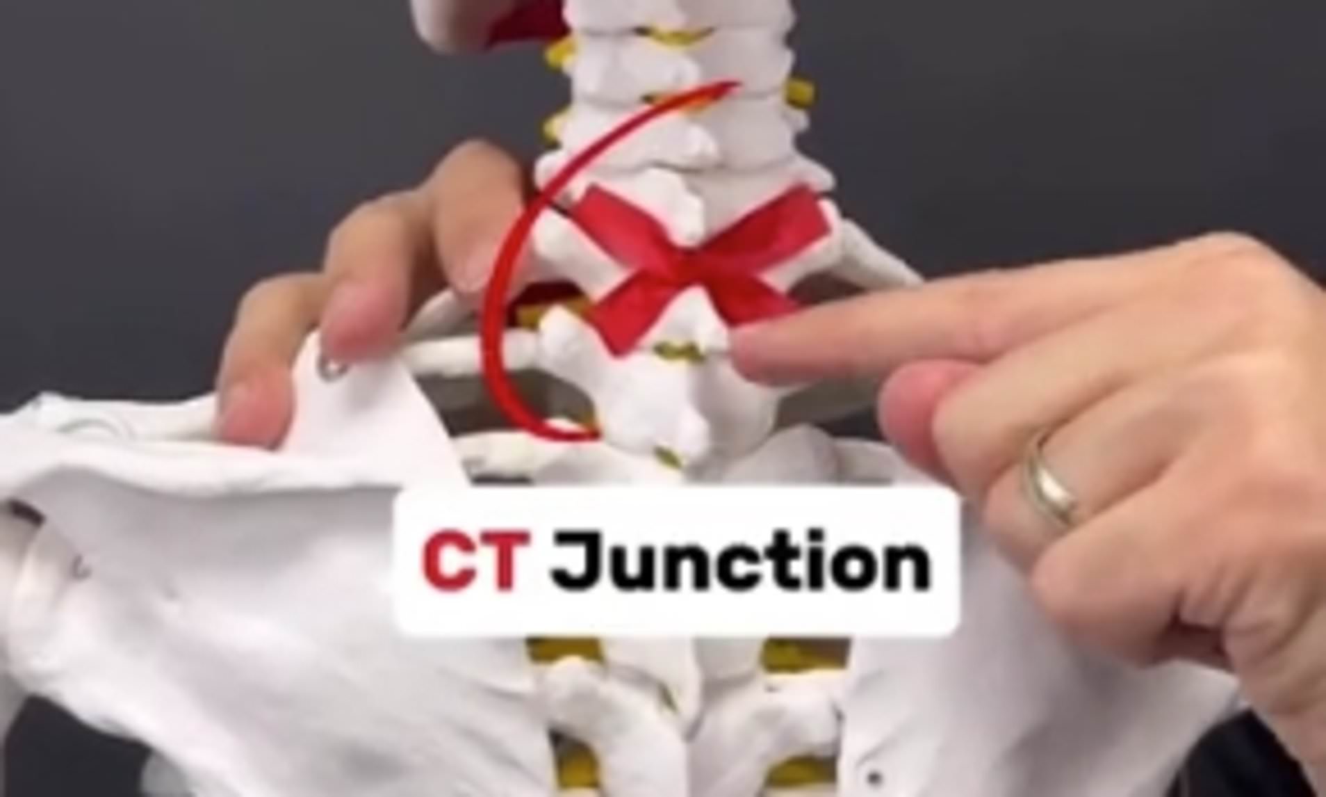 Spinal doctor shares tip to get rid of unsightly neck hump caused by ...