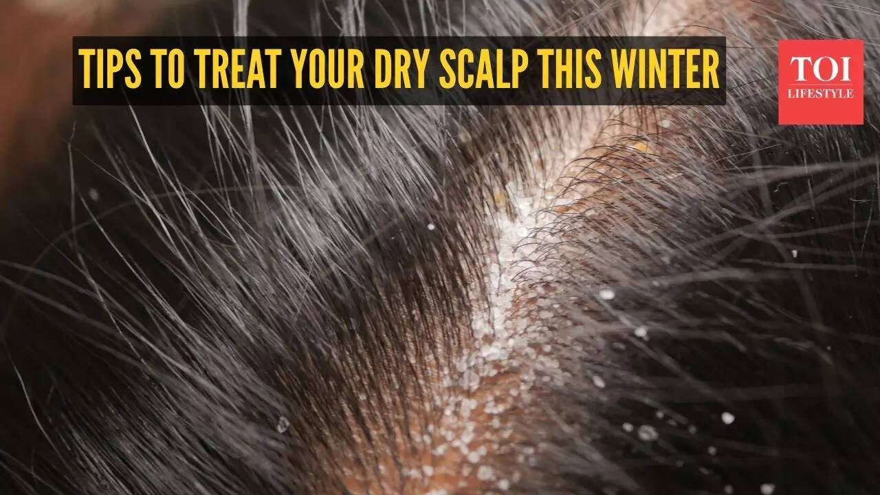 How do you treat a dry scalp in winter? Dermatologists share what ...
