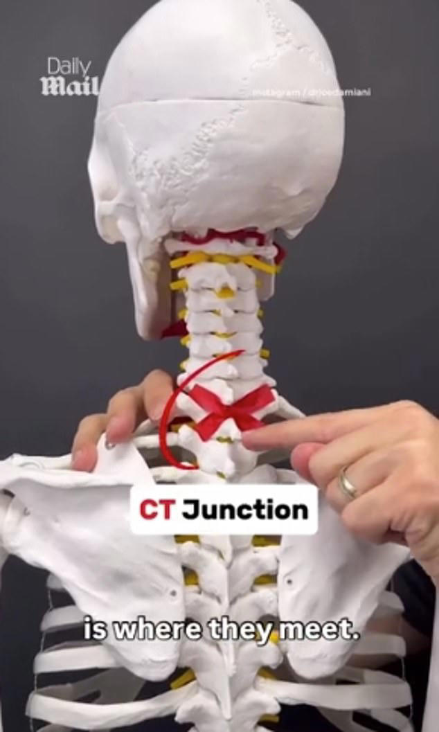 Spinal doctor shares tip to get rid of unsightly neck hump caused by ...