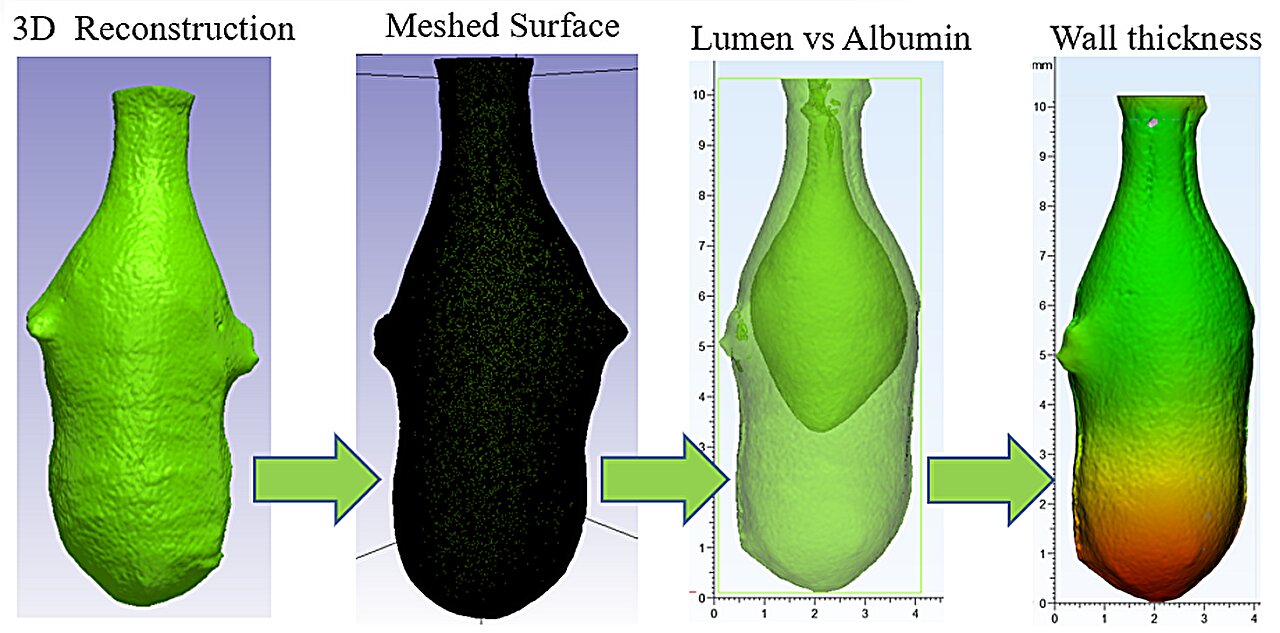 Unfolding the truth about bladder function: New insights into how the ...