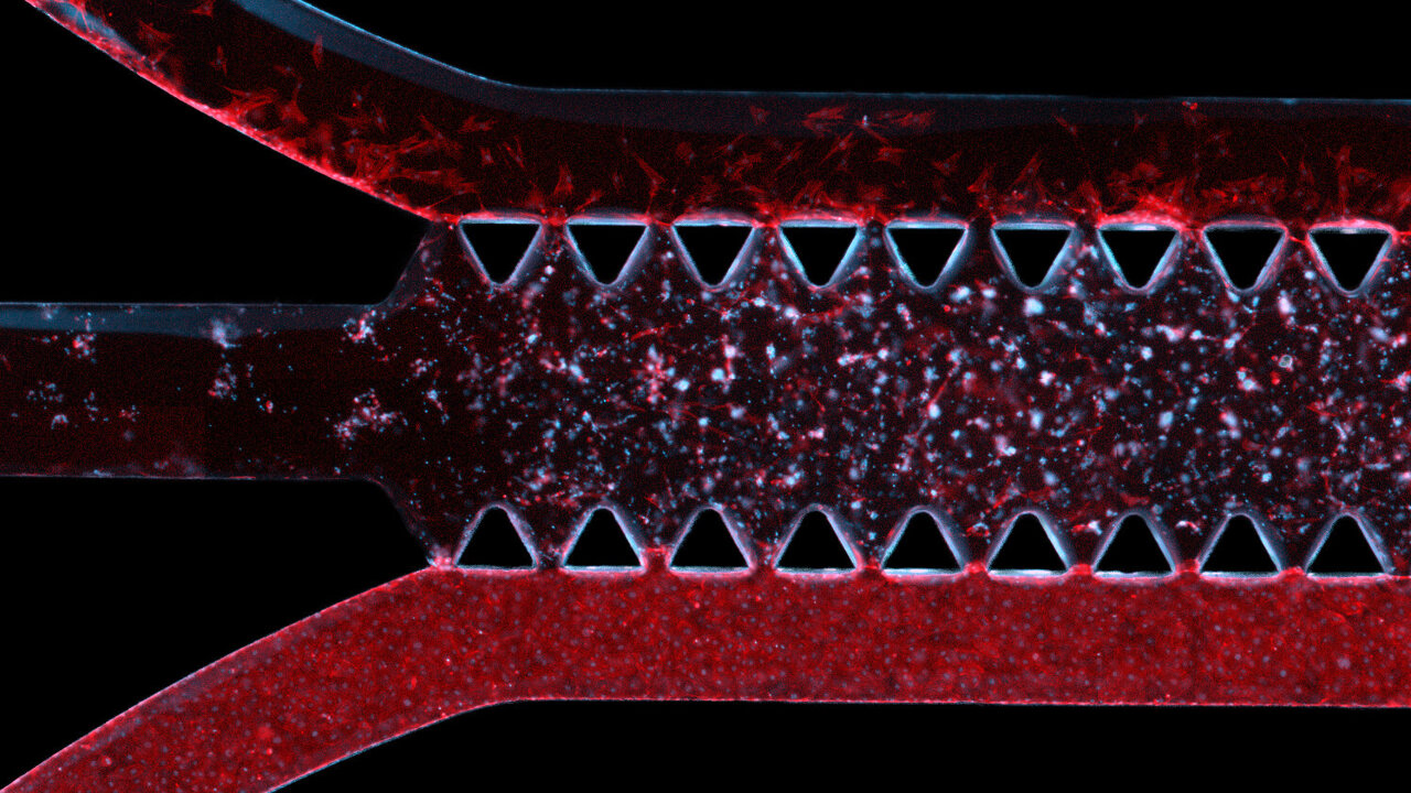 Preventing brain damage in premature babies: Lab-grown brain model ...