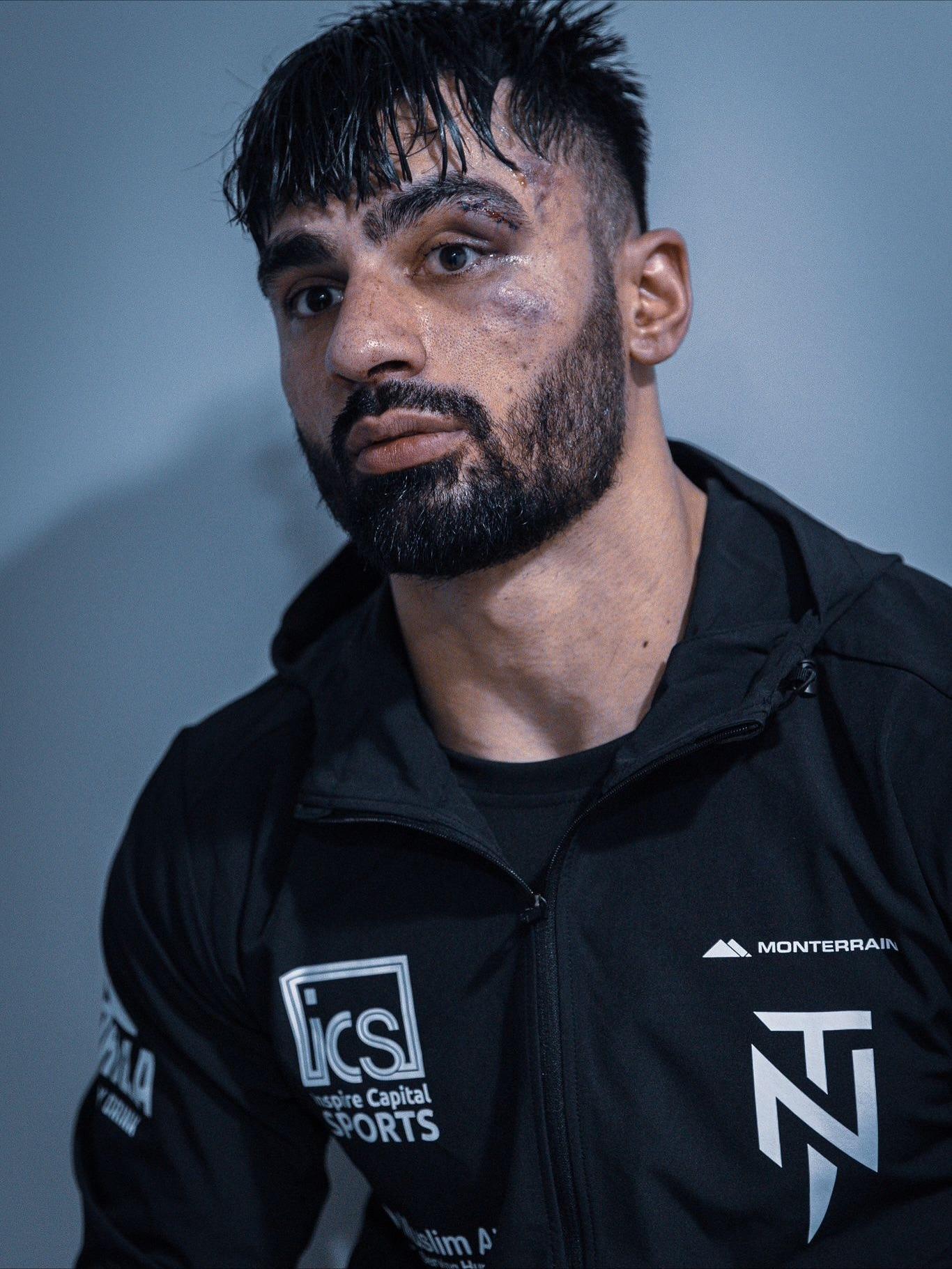 Eye injury costs South Yorkshire boxer £25,000