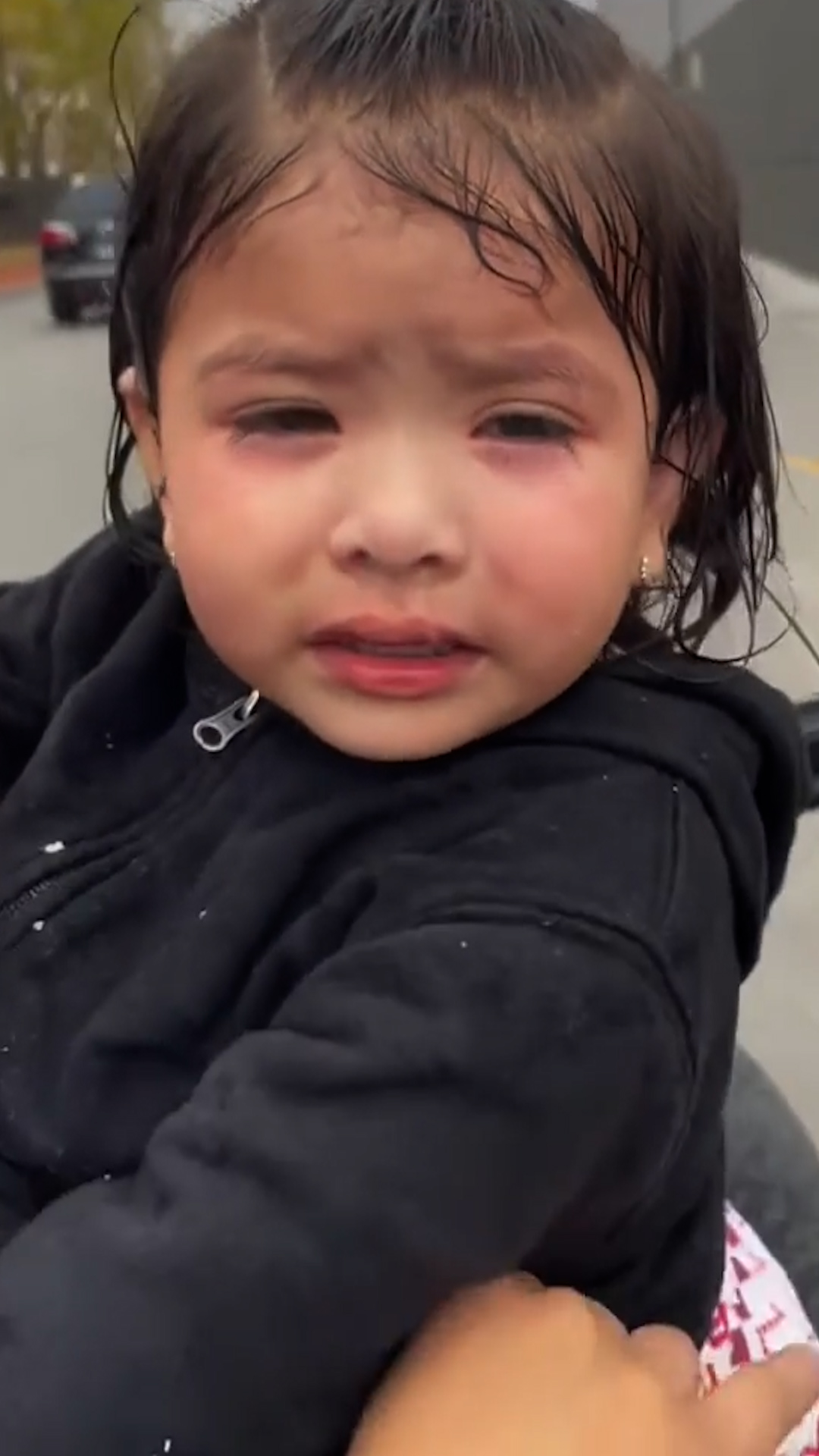 Baby Hospitalized After ICE Spray