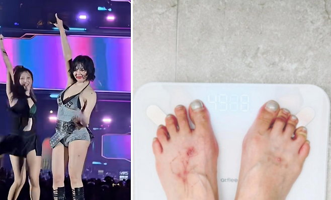49kg 뼈말라가 뭐길래…현아, 10kg 감량 후 참여한 마카오 콘서트에서 실신
