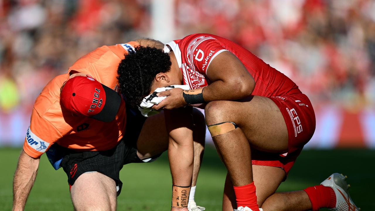 NRL star opens up on brain bleed scare