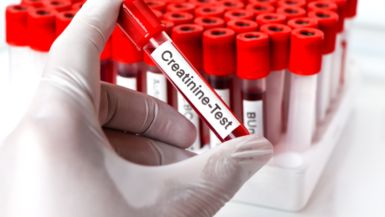 How to safely reduce creatinine levels without medication