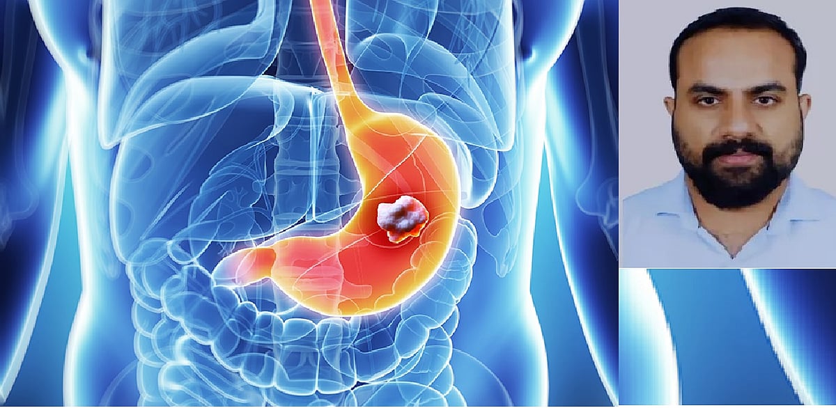 When Common Stomach Problems Could Signal Something More