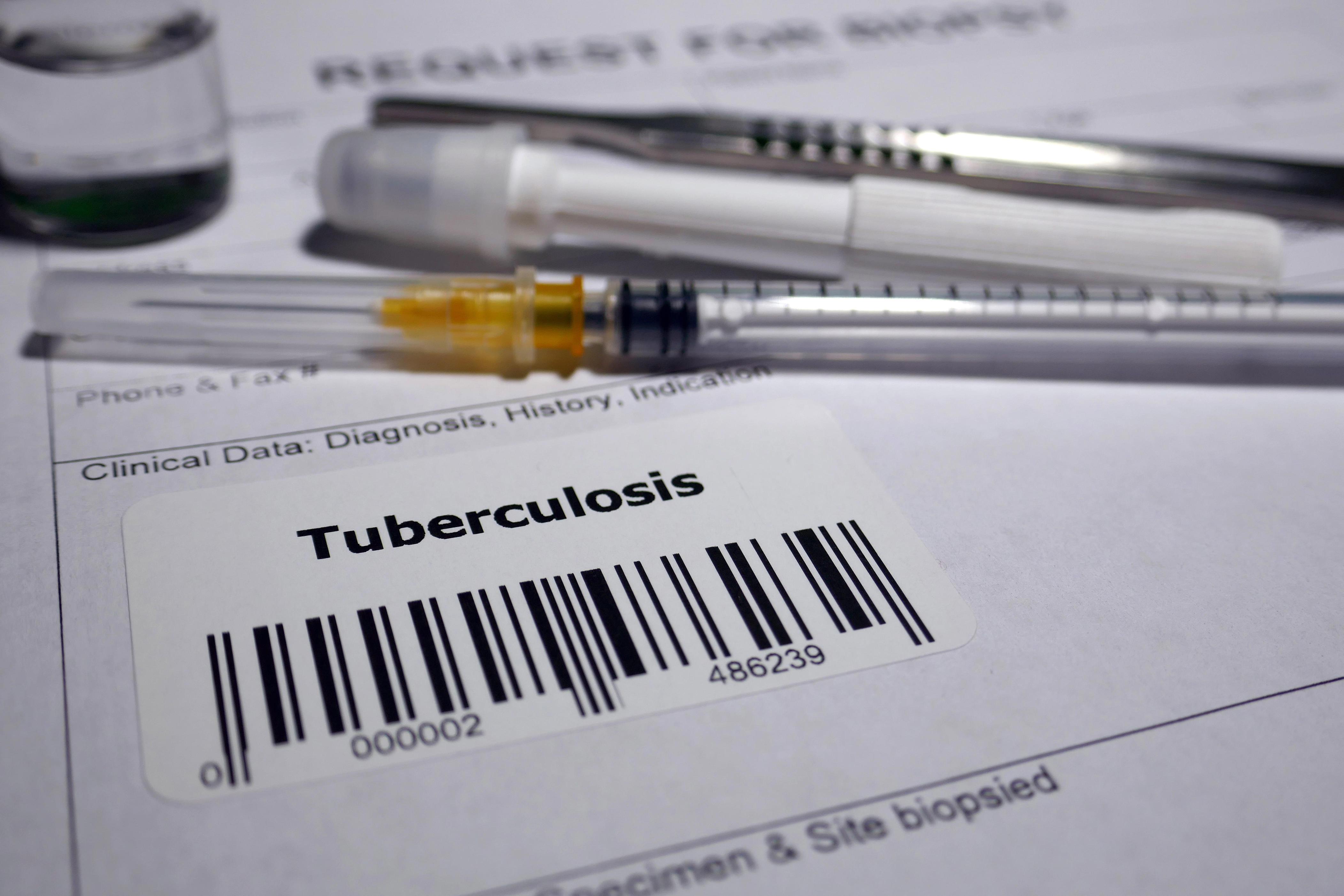 What you need to know about tuberculosis testing, vaccine longevity