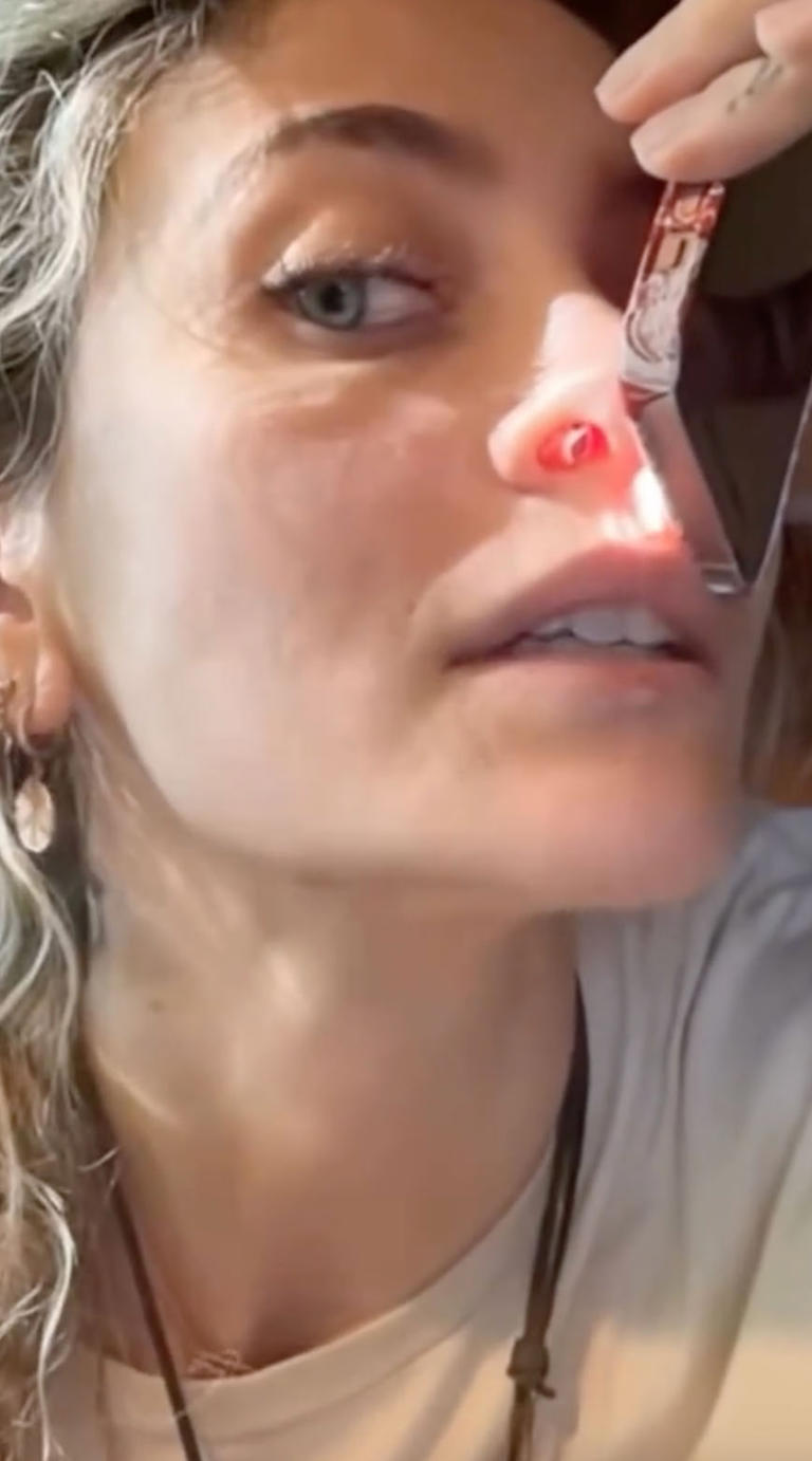 Paris Jackson shows off perforated septum caused by years of drug abuse ...
