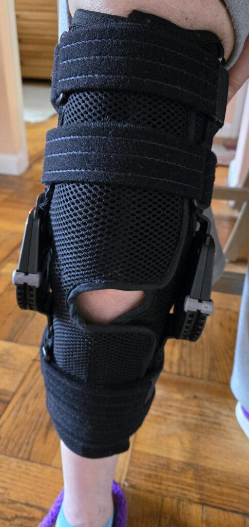 Electric bike riding wrong way in bus lane leaves woman with severe ...