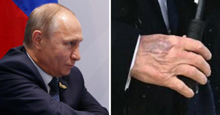 Putin’s Health Rumors Refuse to Die – New ‘Shriveled Hand’ Footage ...