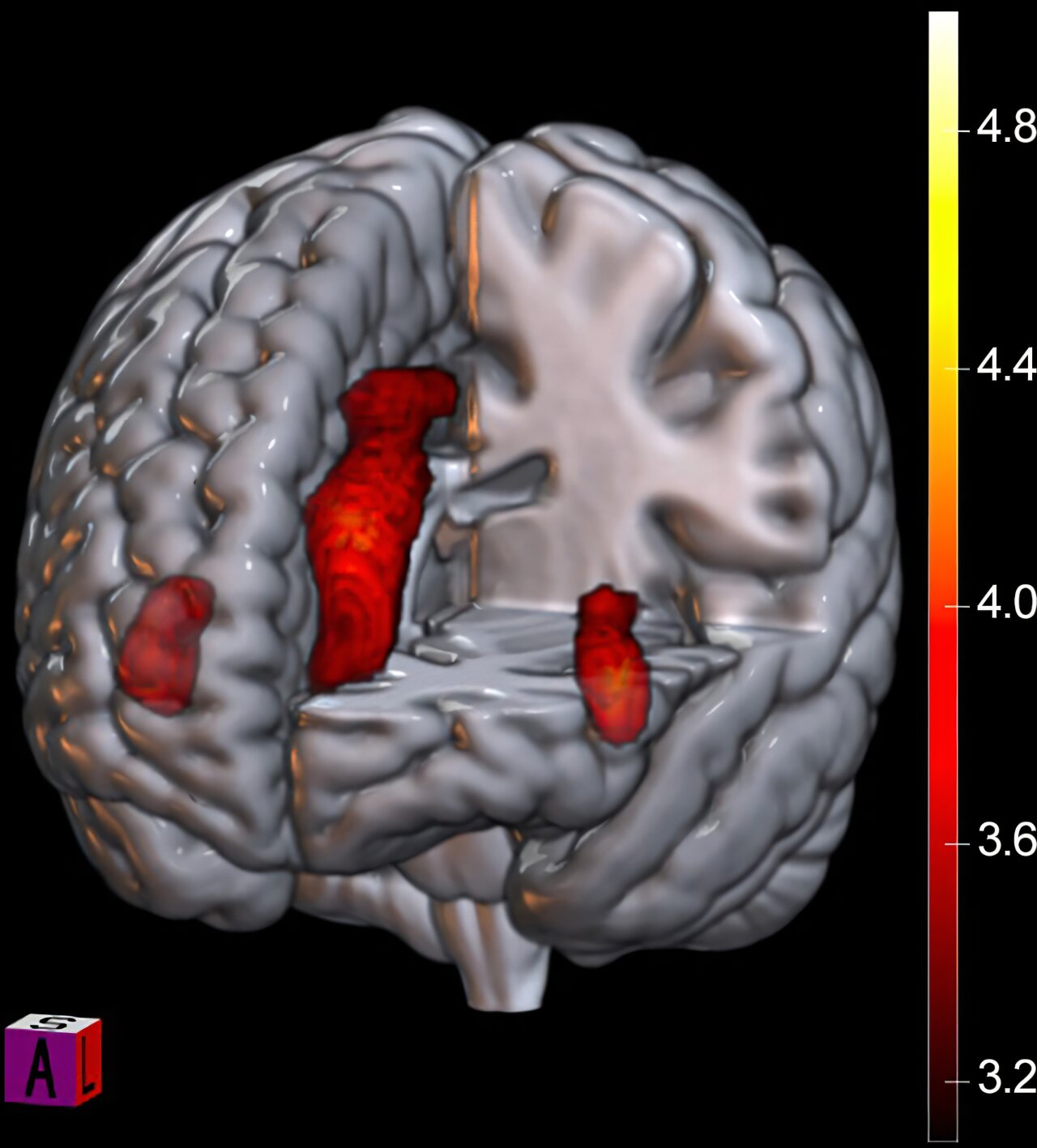 Brain activity goes to extremes in soccer fans, neuroimaging reveals