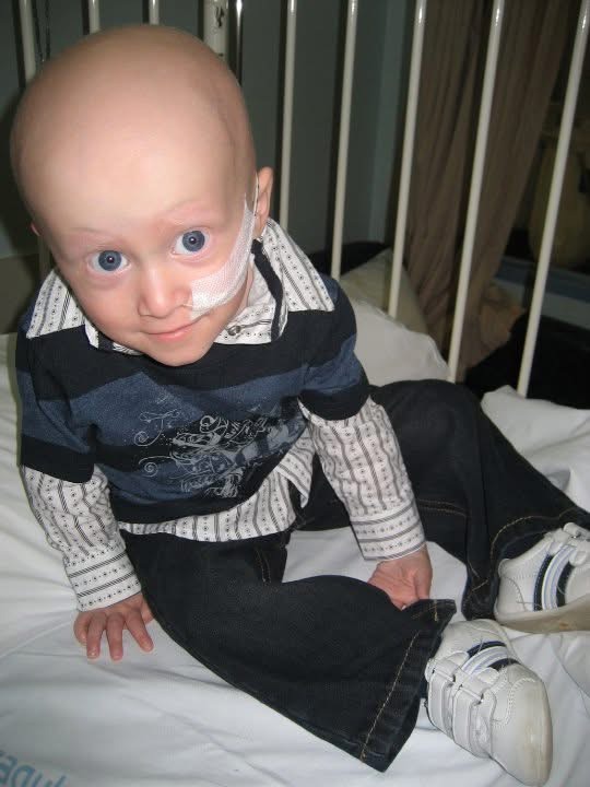 A tumour the size of a football led to Ethan's 600-day stint in Ronald ...