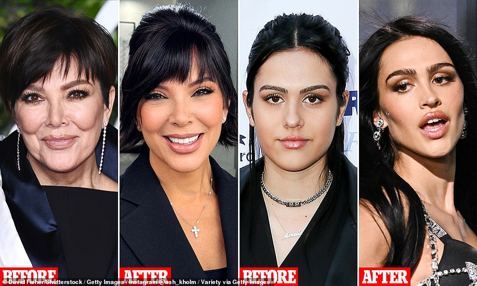 Hollywood's major cosmetic transformations of 2025