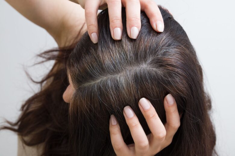5 sneaky causes of premature gray hair (& what to do about it)