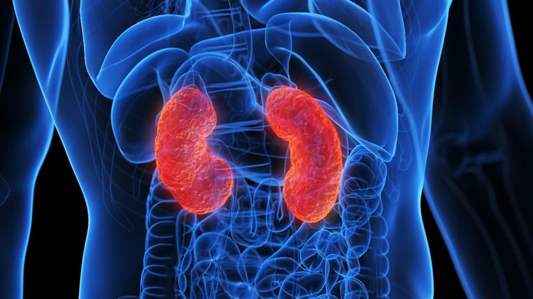 India's chronic kidney disease crisis exposes deep cracks in preventive ...