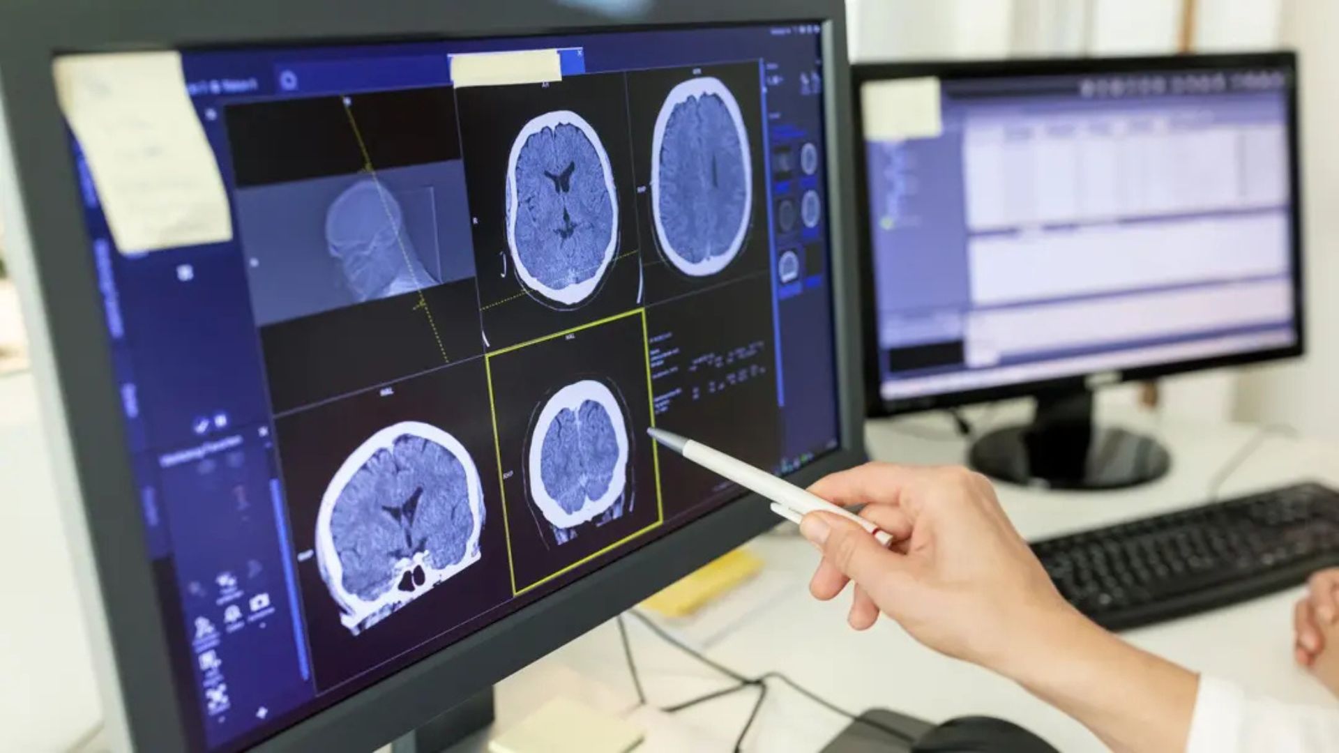 Scientists achieve targeted seizure control using sound waves and gene ...