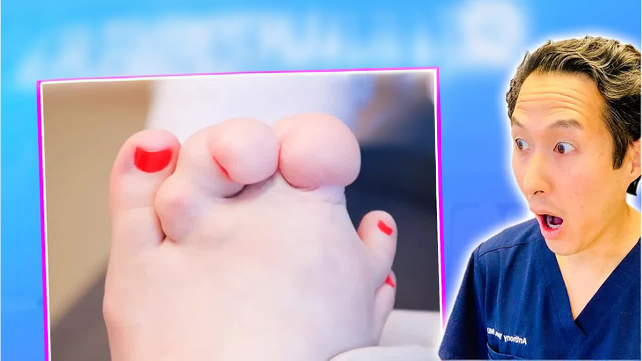 Plastic Surgeon Reacts to My Feet Are Killing Me’s Massive Foot Case