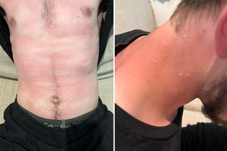 Uproar as crews 'forcibly' enter Aussie homes to tackle $61 million ...