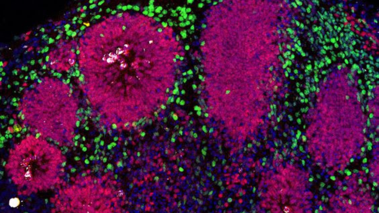 NCBS study links lipid imbalance to brain disorder in Lowe Syndrome ...