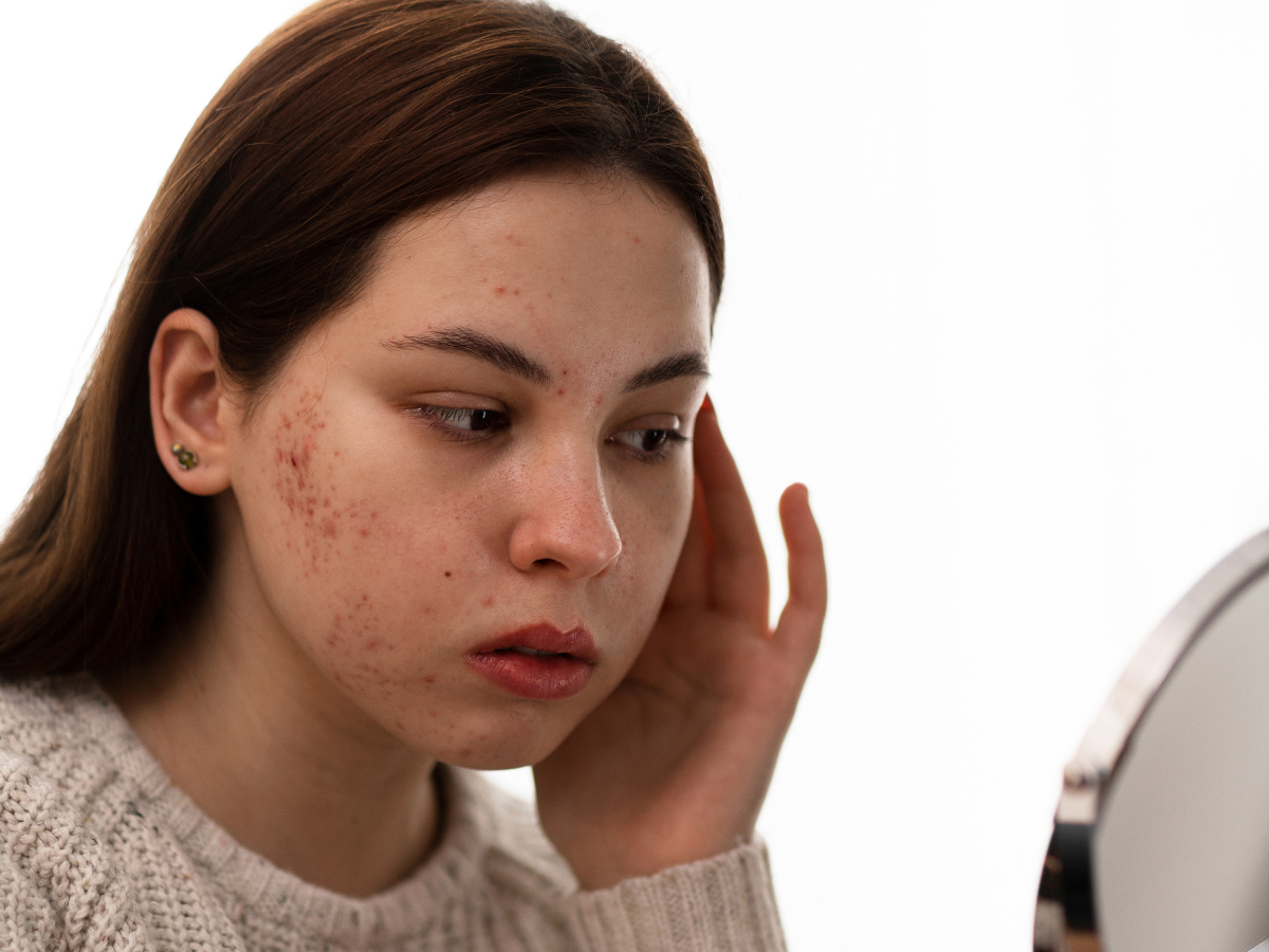 10 Common items that secretly trigger acne, hair growth and fatigue