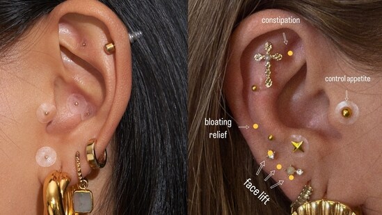 Ear Seeding: These tiny stickers are a fashionable way to de-stress