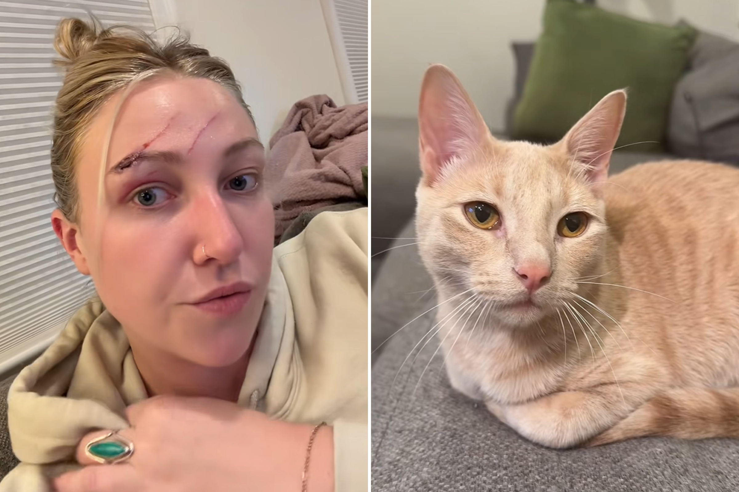 Woman left with two huge cat scratches on face—then has horror realization