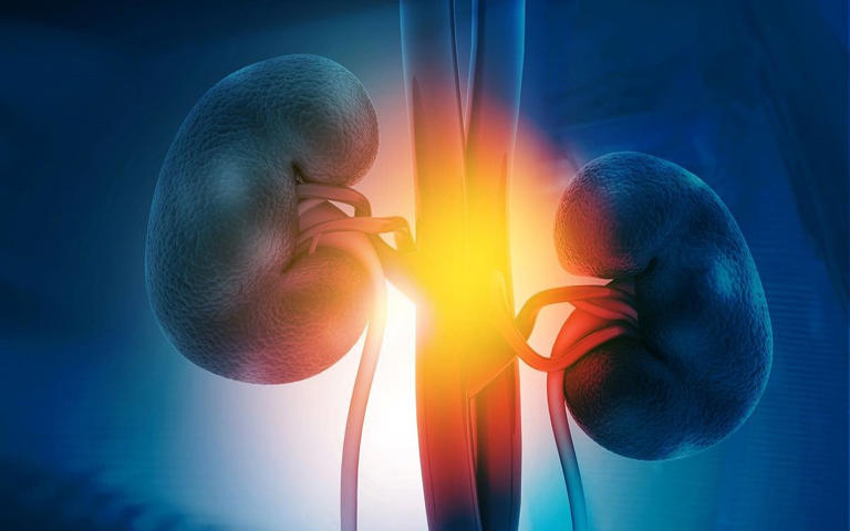 ASN: Expanding Kidney Transplant Wait List Criteria to Include Risk for ...