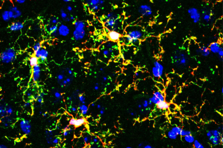 Research in mice reveals brain cells that drive—and prevent—anxiety