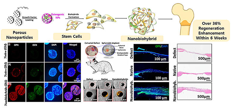 Nanoparticle–stem cell hybrids open a new horizon in bone regeneration
