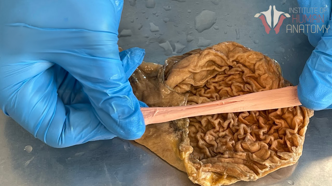 Swallowed gum: Myths vs. medical fact