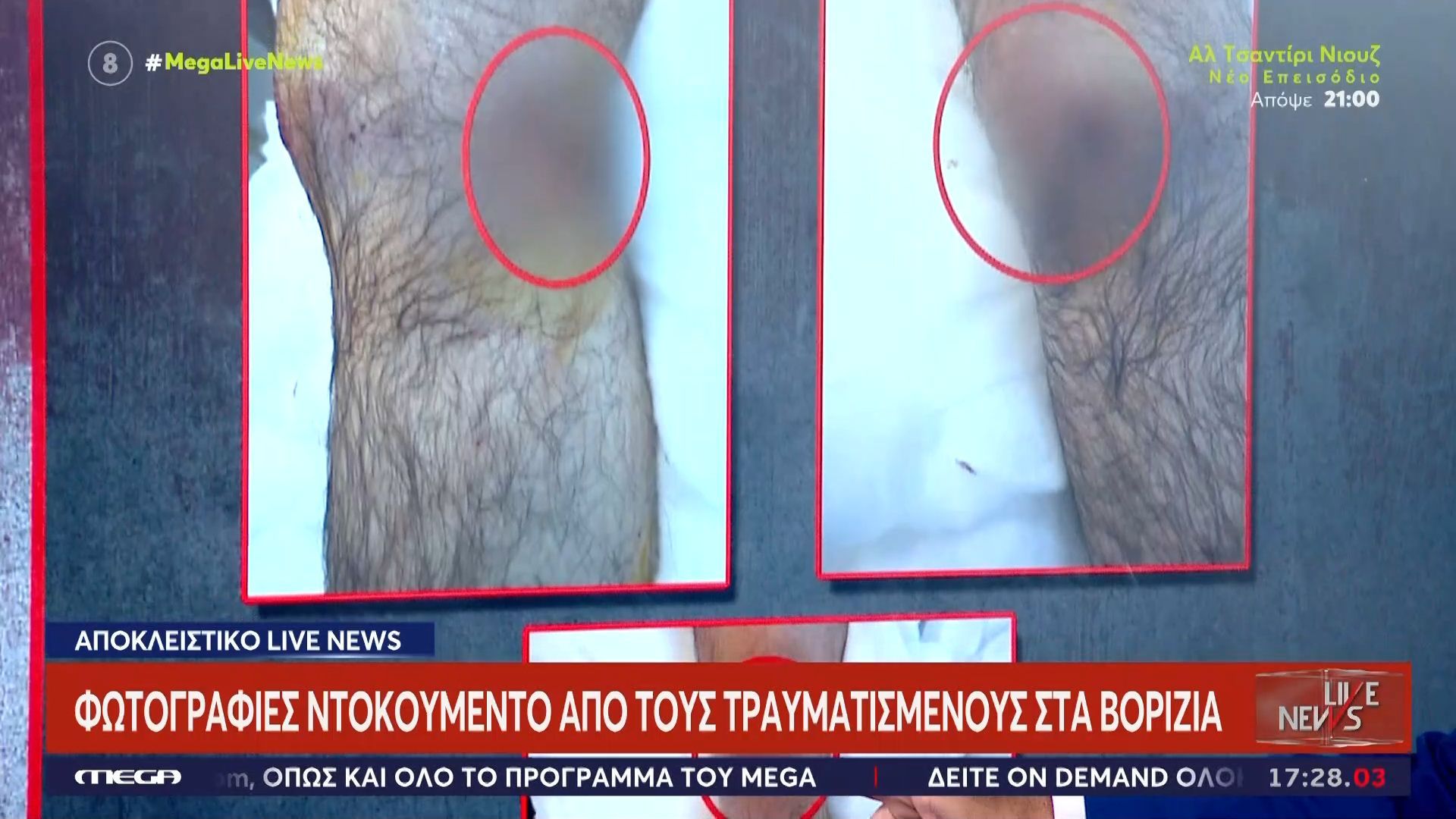 Μακελειό στα Βορίζια: Εικόνες με τους τραυματίες μετά την άγρια μάχη
