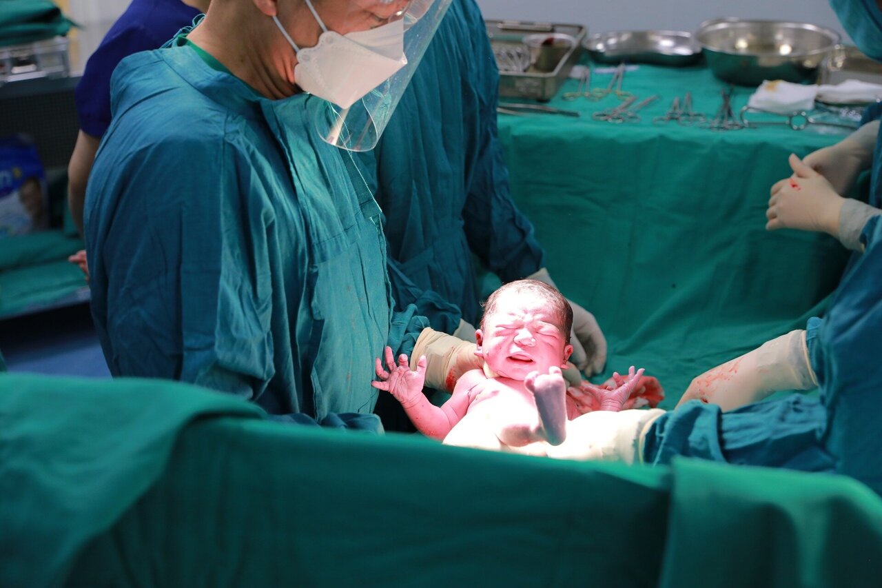 Unplanned cesarean deliveries linked to higher risk of acute ...