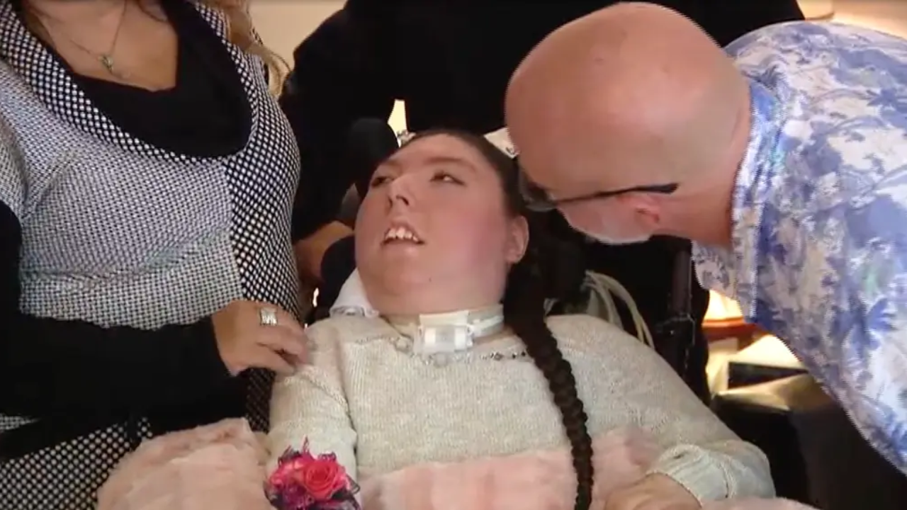 Doctors Said She Wouldn't Live Past 4: Woman Born Without A Brain ...