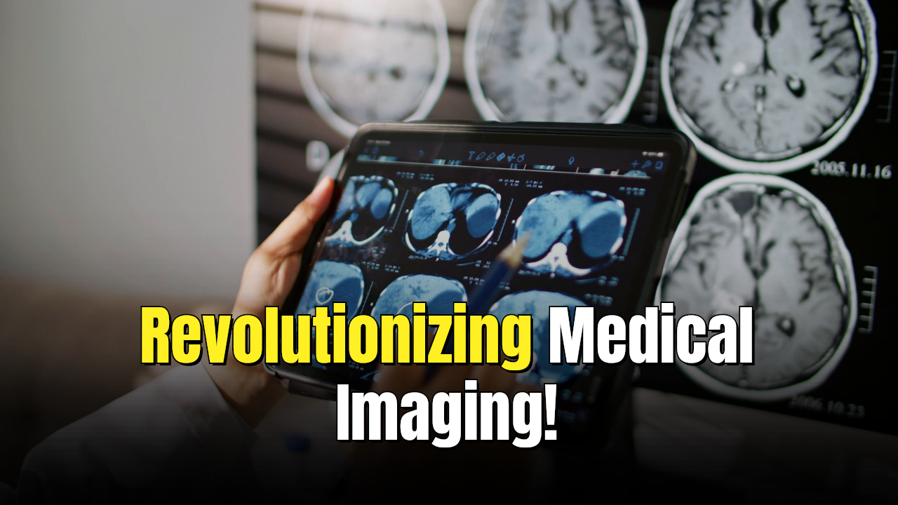 New AI model revolutionizes medical imaging with 90% less computing power
