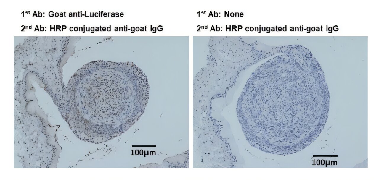 Nasal therapeutic HPV vaccine could prevent cervical cancer