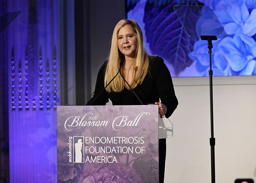 Amy Schumer deletes all her pre-weight-loss photos for ‘no reason’