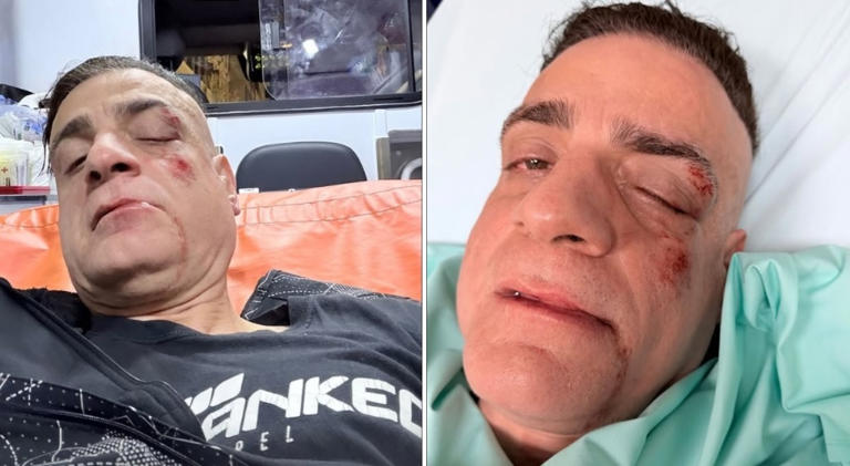 Lo youtuber Cicalone aggredito a Roma: paura e violenza mentre ...
